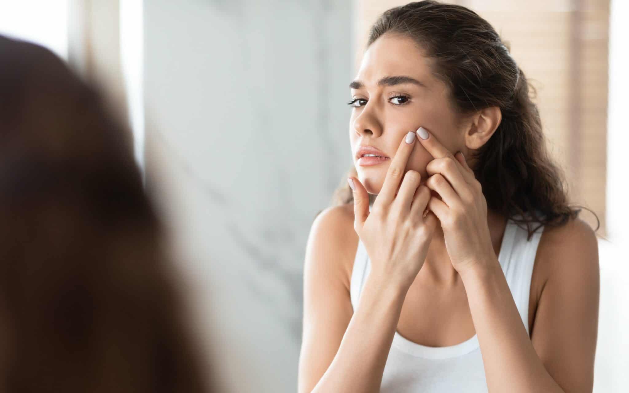 What Are Blackheads? Causes, Treatments & Prevention | The Derm Spot