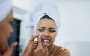 How to Get Rid of Closed Comedones: Effective Treatment Tips | The Derm ...