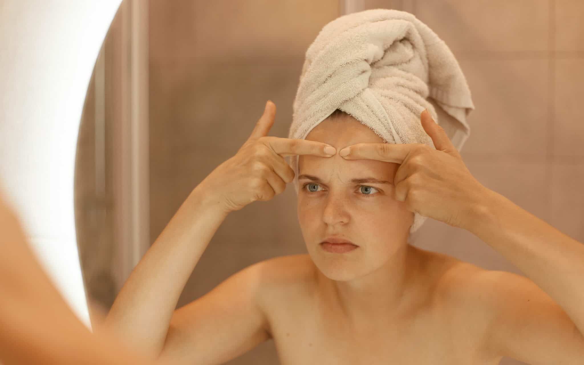 Closed Comedones on Forehead: Causes & Treatment | The Derm Spot