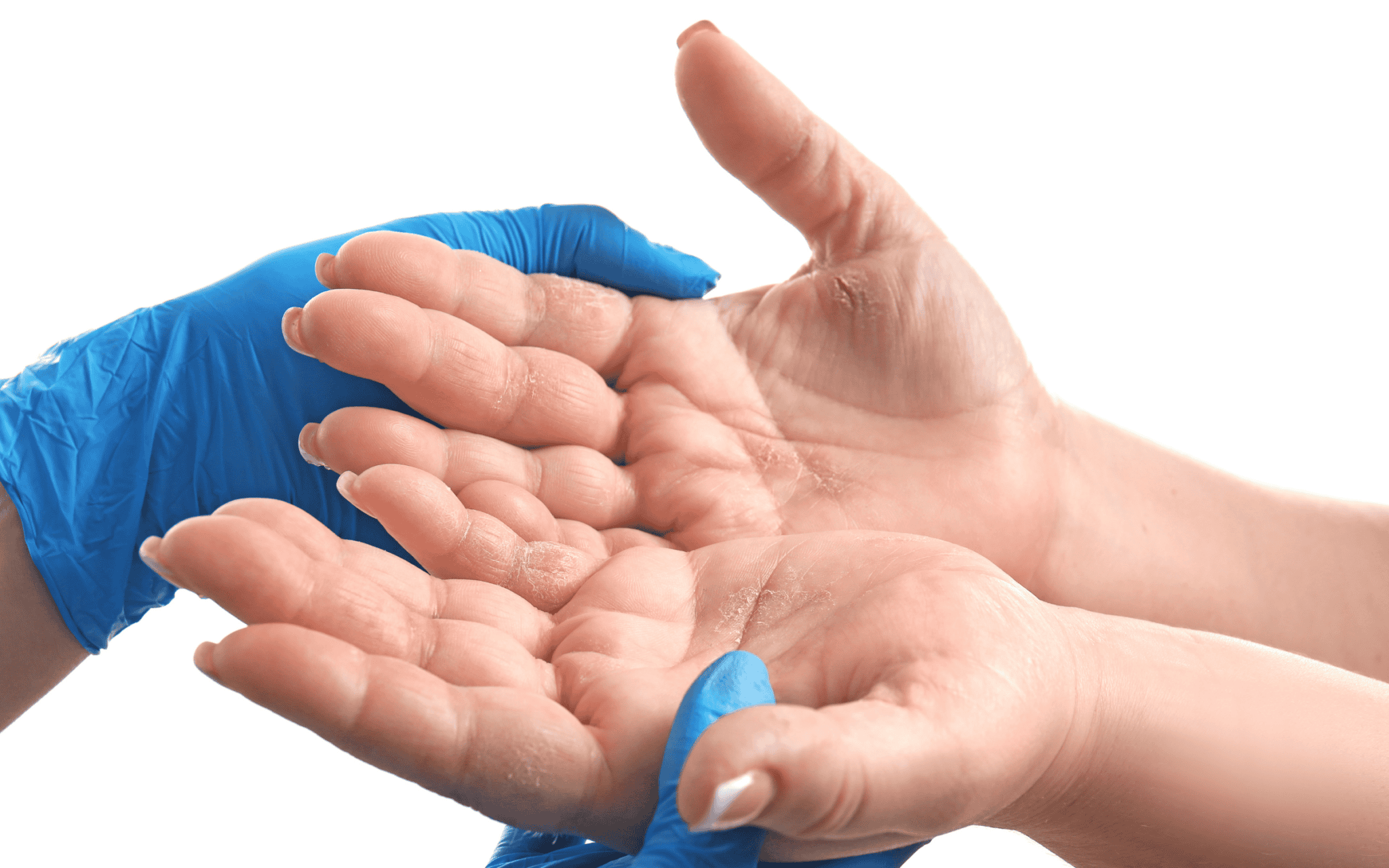 How to Stop Skin Peeling on Hands in 2026
