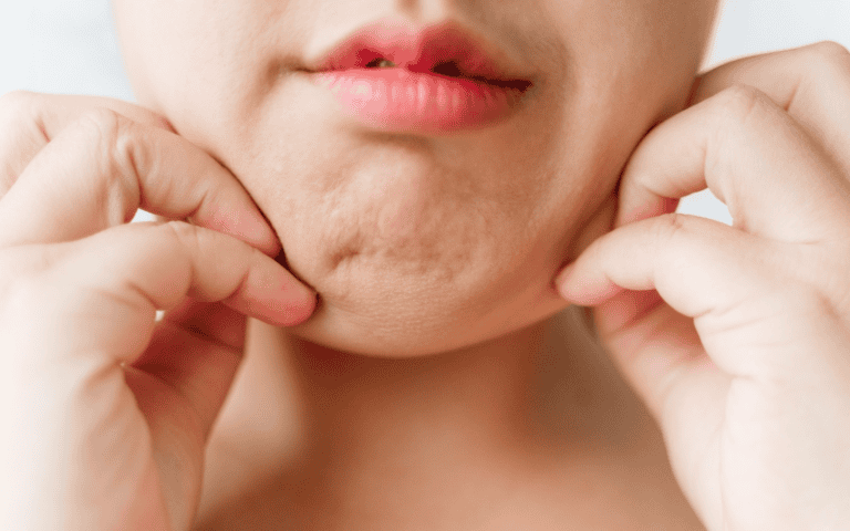 Puffy Face: Causes, Treatments & Skincare Tips | The Derm Spot