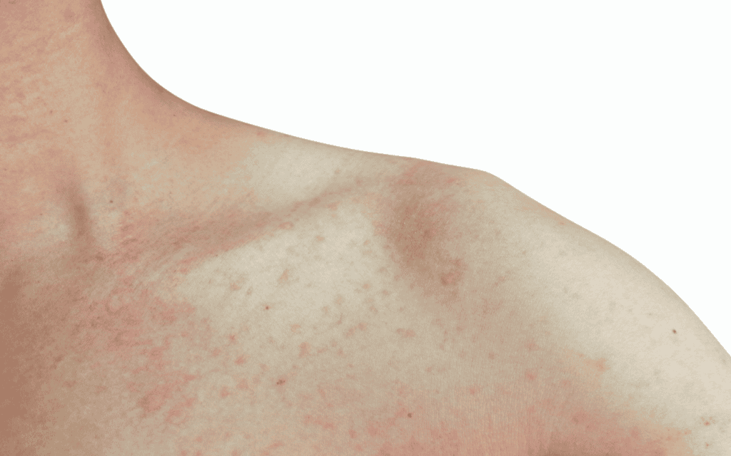 Understanding Rough and Bumpy Skin: Causes, Treatments, & Prevention Tips