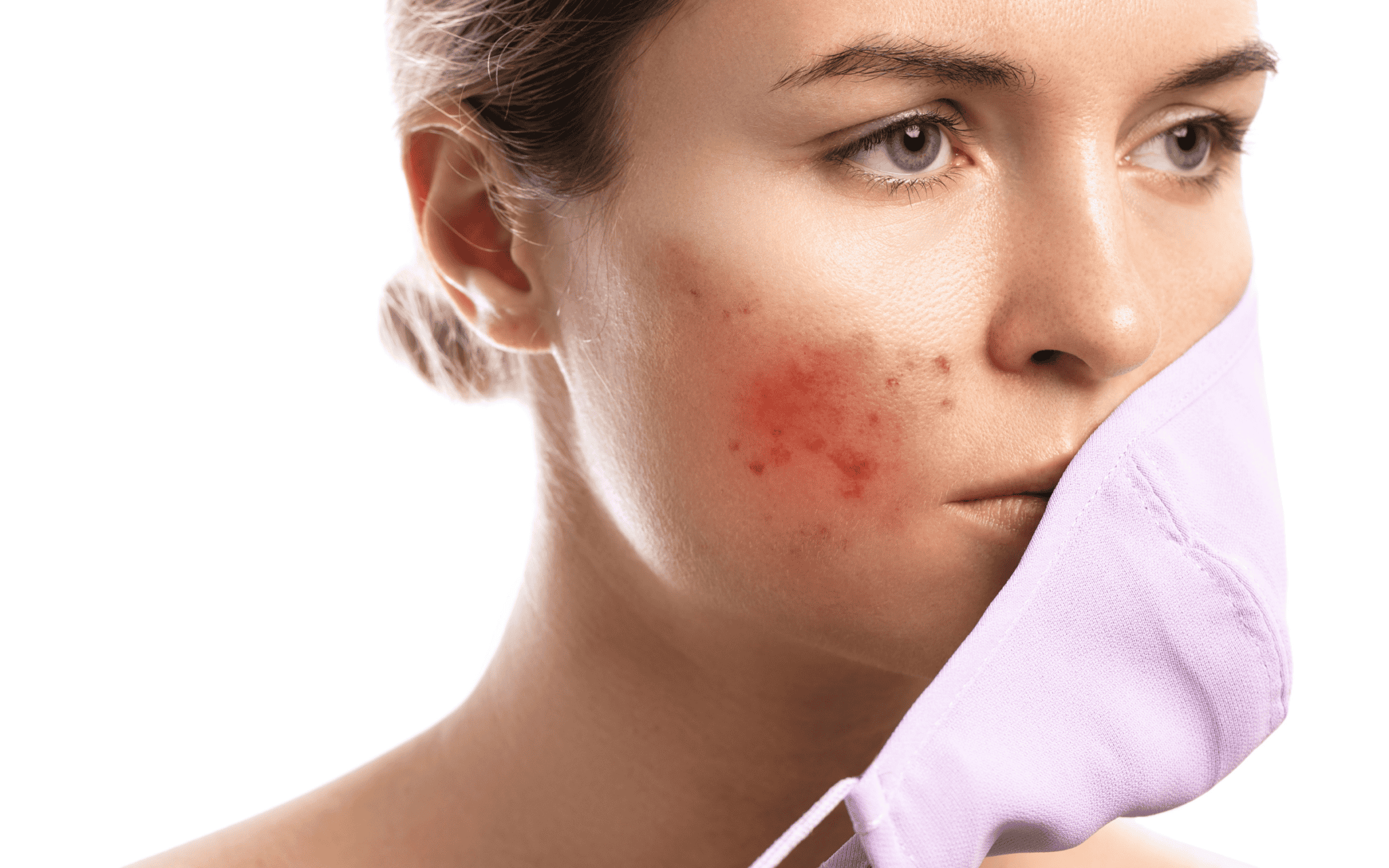 What is Cortisol Face? Effects on Skin and Hair Health Explained