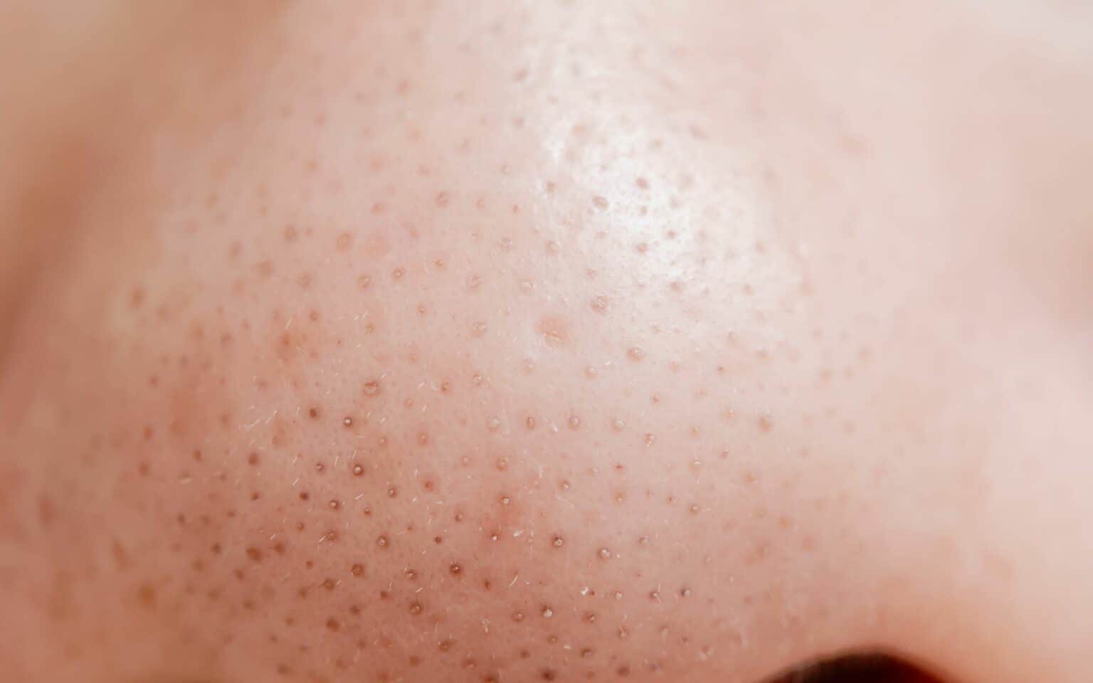 Puffy Face: Causes, Treatments & Skincare Tips | The Derm Spot