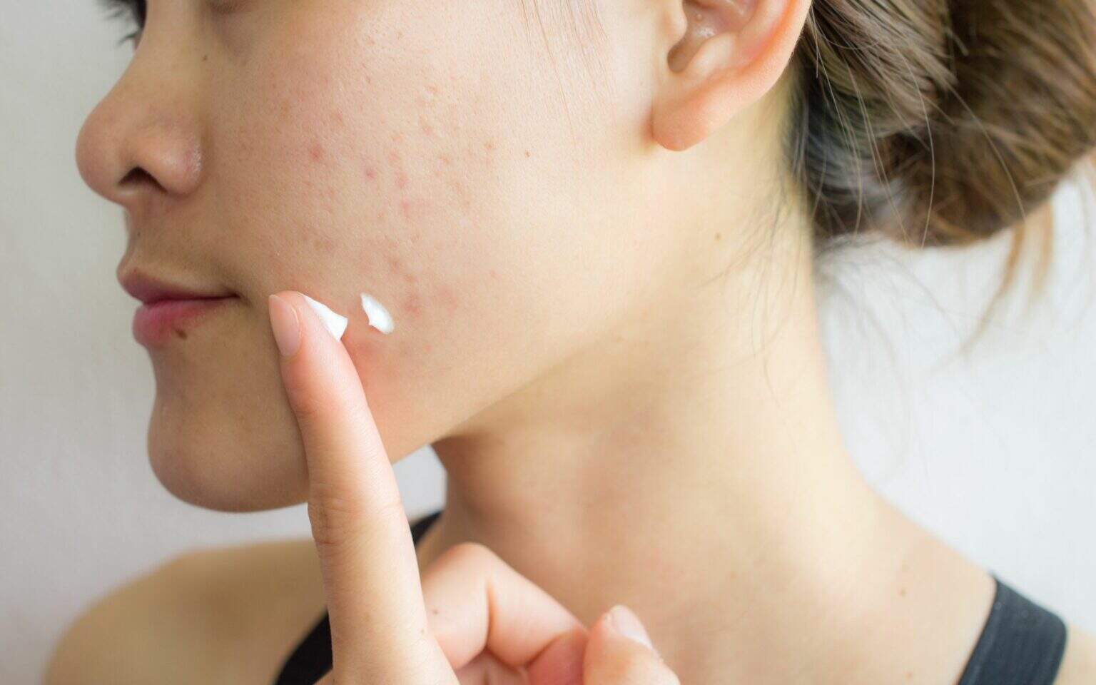 Sallow Skin in 2025: Causes, Treatments and Care Guide